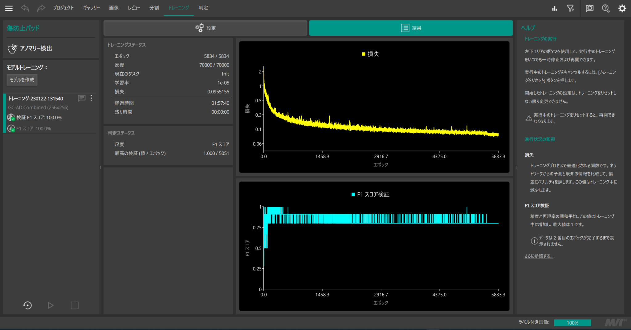 MVTec Deep Learning Tool × FIS-200DL | 京都の外観検査装置メーカー オービット MVTec Deep Learning Tool × FIS-200DL | 京都の外観検査装置メーカー オービット